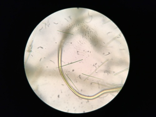 Family Phormidiaceae · MINKA